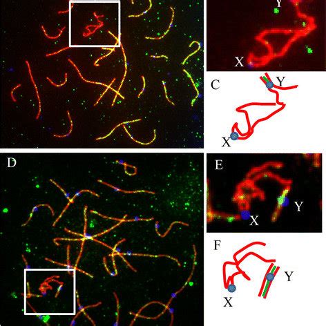 Sex Chromosome Pairing And Recombination In The 47 XYY Patient Download Scientific Diagram