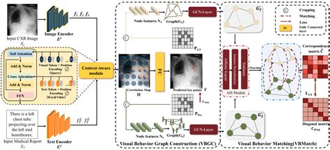 논문 리뷰 Gem Context Aware Gaze Estimation With Visual Search Behavior Matching For Chest Radiograph