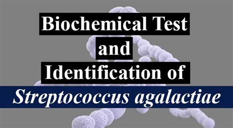 Biochemical Test And Identification Of Streptococcus Agalactiae