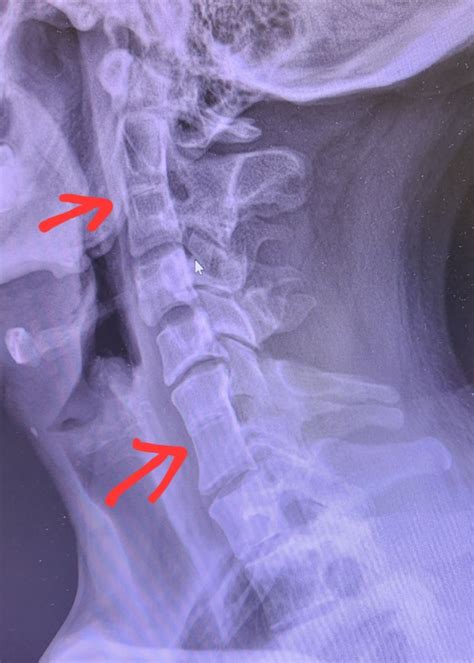 이럴 땐 어떤 병원을 가봐야 할까요 지식in