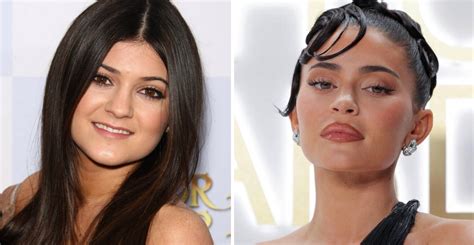 Kylie Jenner Insists She Hasnt Had Much Plastic Surgery On Her Face