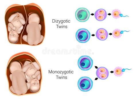 Fraternal Twins Fetal Development