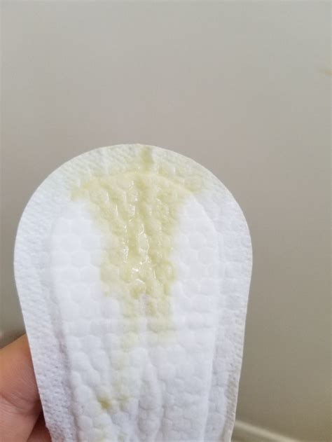 Yellowish Green Discharge
