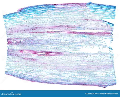 Sunflower Stem Helianthus Annuus Longitudinal Section 20x Micrograph Royalty Free Stock Image