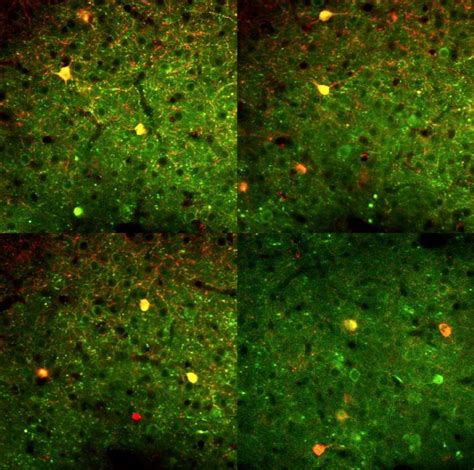 Neuroscientists Reveal Fundamental Discovery About Cortical Neurons
