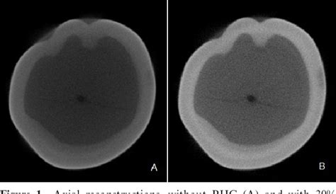 Figure 1 From Beam Hardening Correction Tool Improves The Diagnosis Of Incipient Caries Lesions