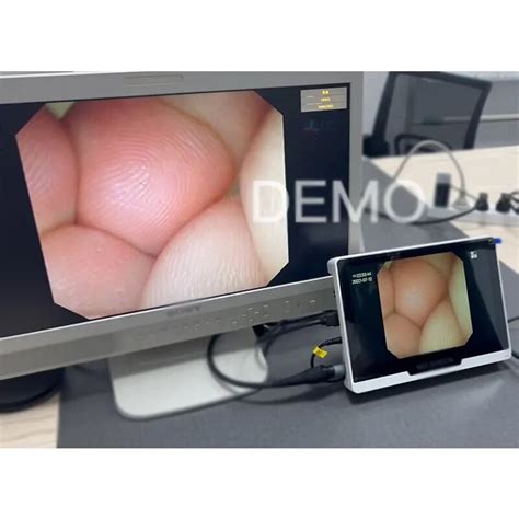 High Quality Flexible Video Cystoscope Cystonephroscope Bladder Endoscope Urology Endoscope