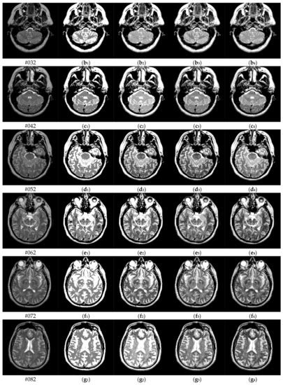 A Novel Interval Iterative Multi Thresholding Algorithm Based On Hybrid