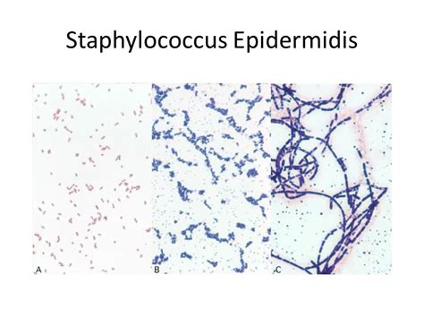 Bacteria Bacteria On The Tip Of A Pin Ppt Video Online Download