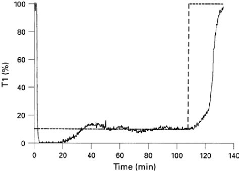Sample Clinical Trace Obtained With Self Learning Fuzzy Controller