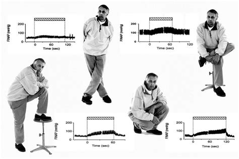 Treatment Of Syncope Syncope