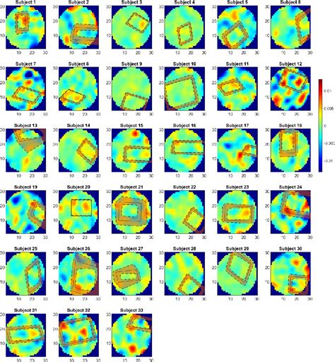 Figure 1 From Bayesian Functional Registration Of Fmri Activation Maps
