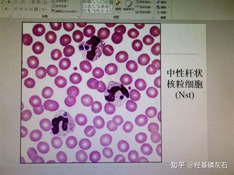 实验诊断——白细胞计数 知乎