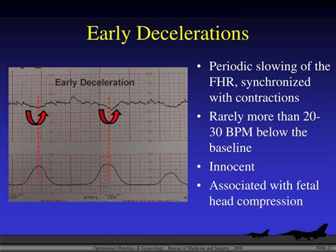Ppt Labor And Delivery Powerpoint Presentation Free Download Id 849084