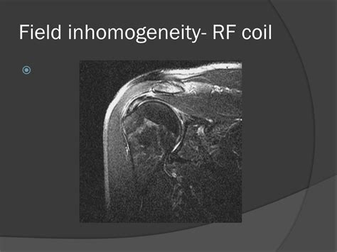 Ppt Mri Artifacts Powerpoint Presentation Free Download Id2153316