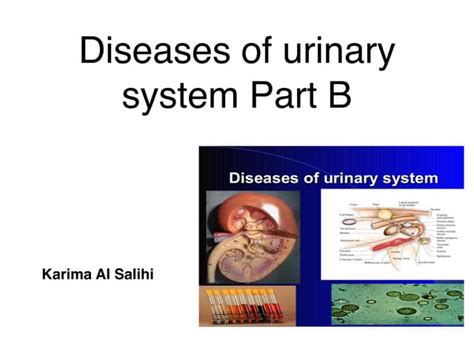 7 Diseases Of Urinary System Part B Pdf