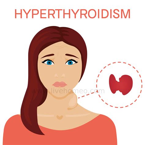 Get Relief From Hyperthyroid Disorders Livehomeo Livehomeo Homeo Directory