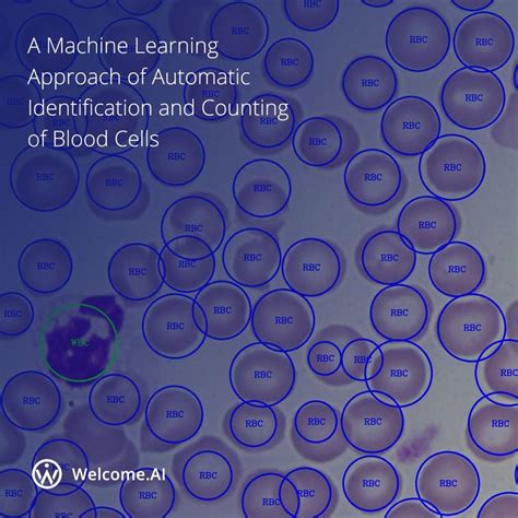 Engineers Mohammad Tariqul Islam And Mohammad Mahmudul Alam Have Developed A Machine Learning