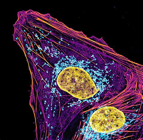 Verayang 드뎌 요아이 업뎃 했어유 ~ 넘 많이 기다리게 해서 죄송해you 😢 애타신분들위해 Popcorn B L 신상할인 10 3일간