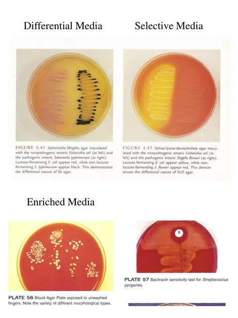 Media Vs Medium Microbiology At Jason Lindstrom Blog