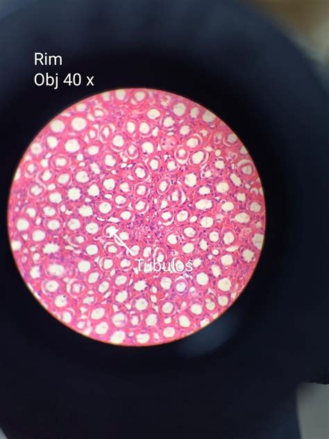 Esquema Do Tecido Epitelial My Xxx Hot Girl