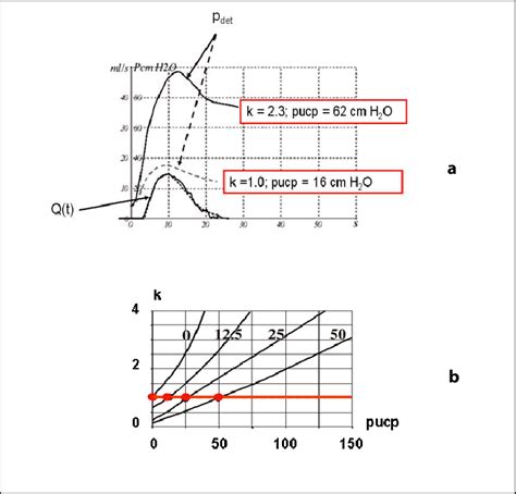 A Modelled Analysis Of A Free Uroflow Qt Of A Bpe Patient Recorded