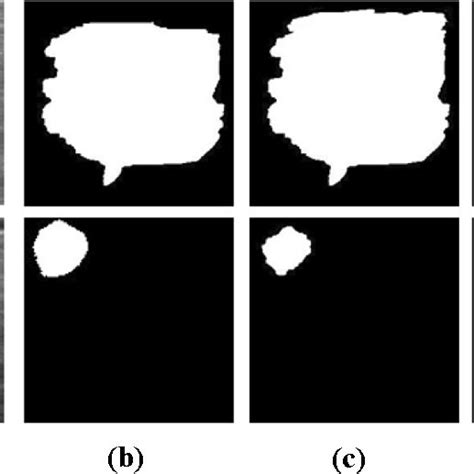 Comparison Of The Thyroid Nodule Segmentation Results Obtained Download Scientific Diagram