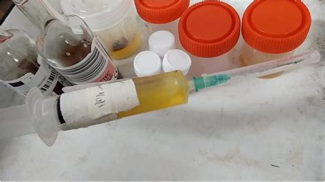 Synovial Fluid Culture And Sensitivity Test Introduction Report Clinical