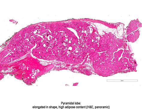 Pathology Outlines Histology