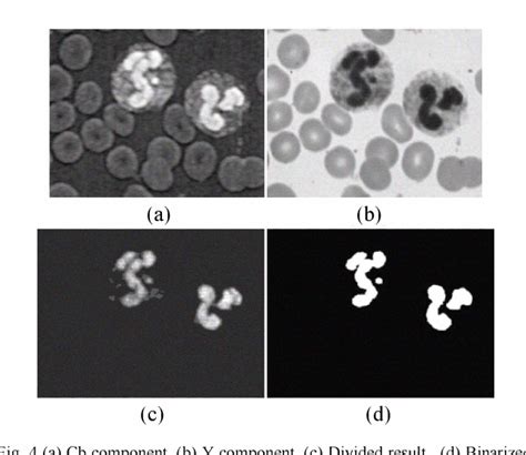 figure 4 from leukocyte s nucleus segmentation using active contour in ycbcr colour space