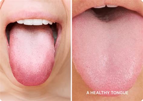 What Is Tongue Diagnosis Unlocking Health Secrets Qi Health