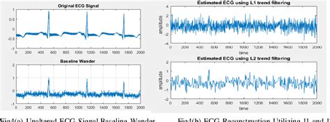 Table 1 From An Ecg Signal Denoising Method Using Filtering Techniques