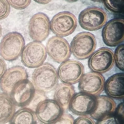 Lots Of Taenia Ova R Parasitology