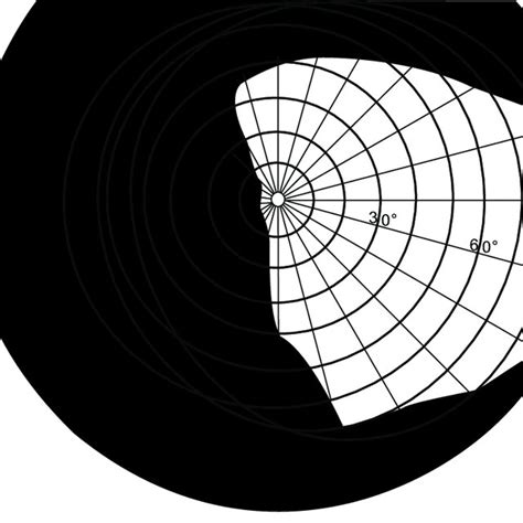 Binocular Visual Fi Eld Plot Representing A Left Sided Hemianopia