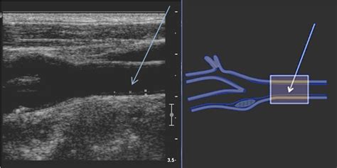 Manual De Doppler Radiologia Online