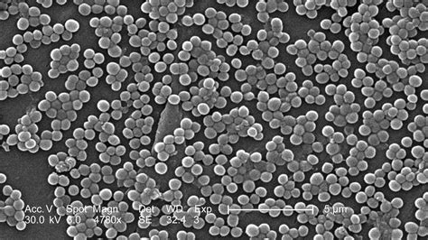 Infections Caused By Staphylococcus Aureus Dental Pockets Blog