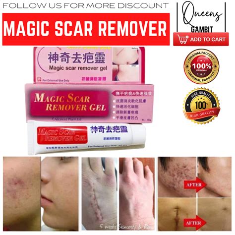 FLASH SALE BEST SELLER ORIGINAL MAGIC SCAR REMOVER Mabisang Pangtanggal PEKLAT