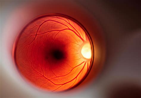 Redox Regulation Of Retinal Neovascularization Via Hif 1α