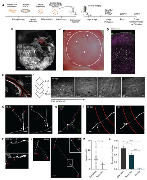 Single Cell Resolution In Vivo Imaging Of Human Cortical Tissue Grafts Download Scientific