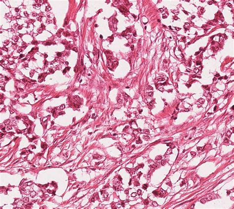 Test Object Detection Dataset V2 Test V2 By Mitosis14 Test Set