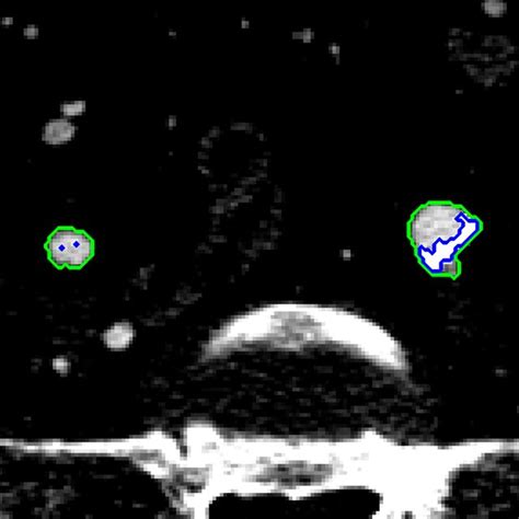 The Approximation Approach To The Segmentation A The Polynomial
