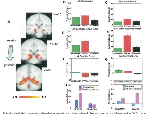 Figure From Spatial And Temporal Episodic Memory Retrieval Recruit Dissociable Functional