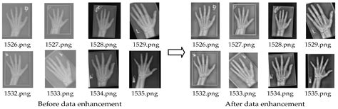 Symmetry Free Full Text Symmetry Based Fusion Algorithm For Bone