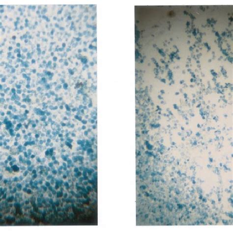 Flow Cytometric Sorting Of Transduced Cd34 Hematopoietic Progenitor Download Scientific
