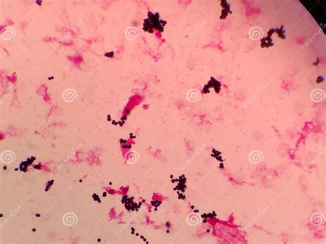 Gram Positive Cocci Biological Sample Gram Color Image Stock Image Du Gramme Coloration