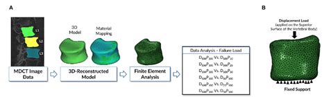 Figure 1 From Finite Element Analysis Based Vertebral Bone Strength