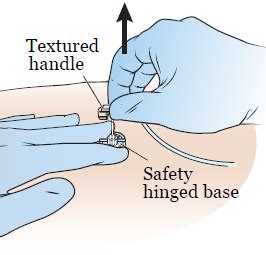 How To Take The Needle Out Of Your Implanted Port Memorial Sloan