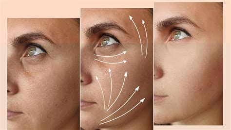 Benefits Of Stem Cell Therapy For Anti Aging In Mexico
