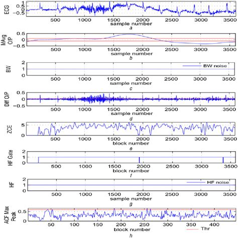 Figure 1 From Noise Aware Dictionary Learning Based Sparse
