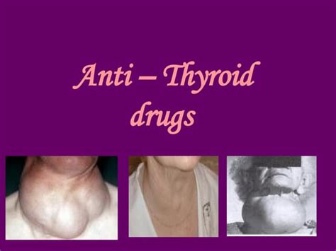 Thyroid Hormones And Anti Thyroid Drugs Ppt